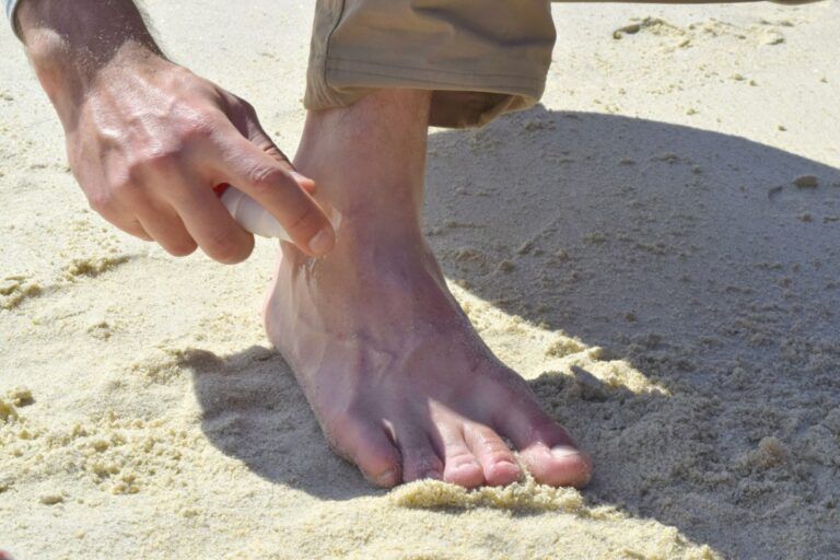 10 Ways to Stop Sandfly Bites - NZ Pocket Guide